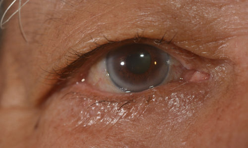 THE OPTICIANS – Part 1: The Eye Examination - Oodo Optical